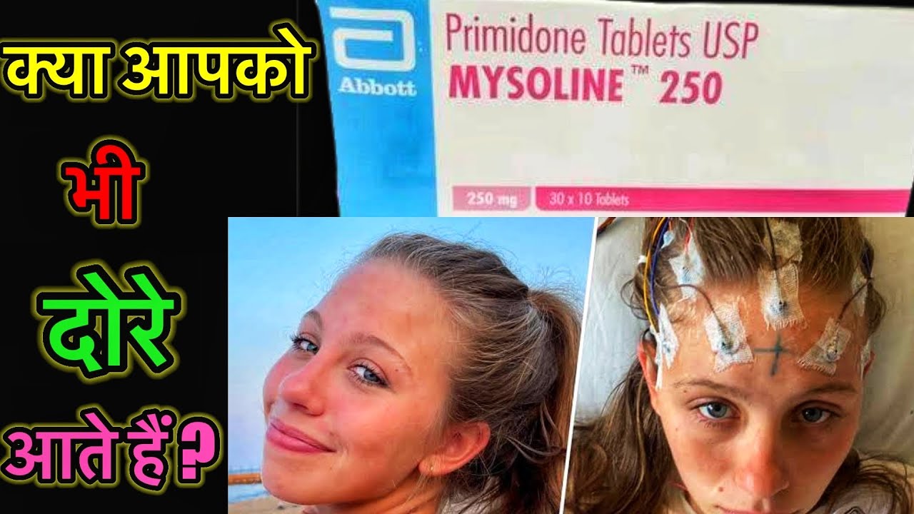 Primidone Tablet | Mysoline Tablet | Epilepsy / Fits / दोरे - जानिए ...