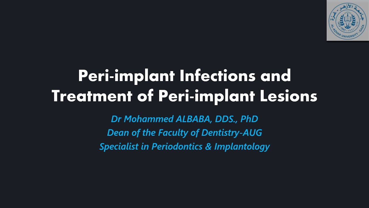 Peri-implant Infections and Treatment of Peri-implant Lesions - YouTube