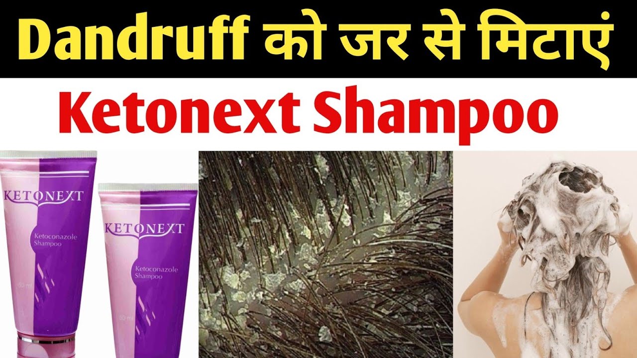 Ketonext Shampoo Anti Dandruff Shampoo || Ketronidazole Shampoo Review ...