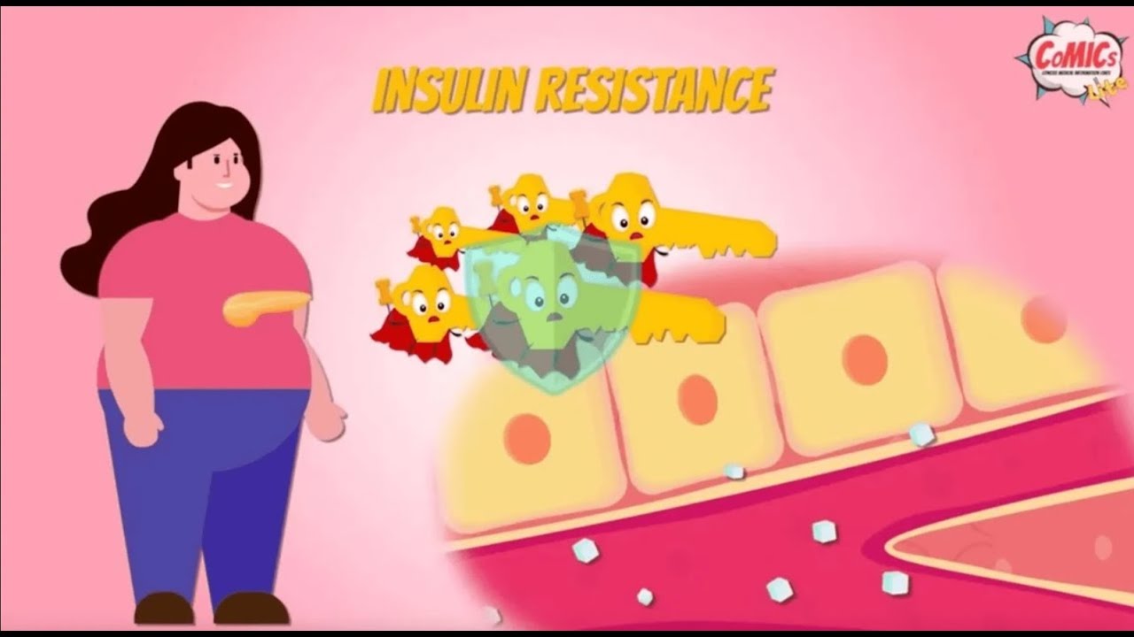 CoMICs Lite Polycystic Ovary Syndrome (PCOS) Ep.101 : PCOS and Weight ...