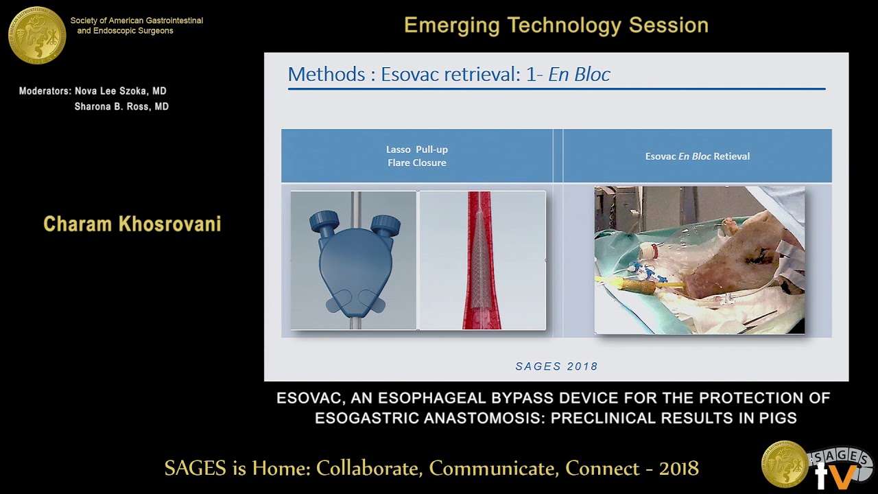 Endoluminal protection of esogastric anastomosis using a temporary non ...