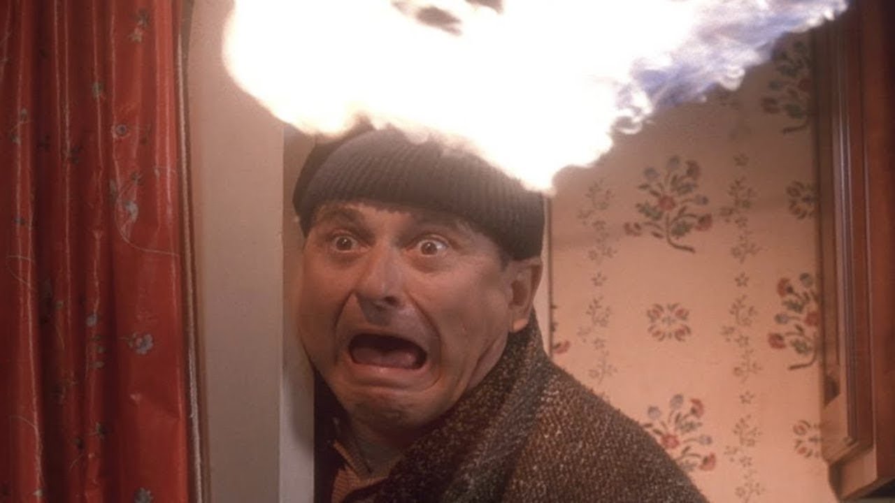 Harry's head being set on fire for 10 minutes - YouTube