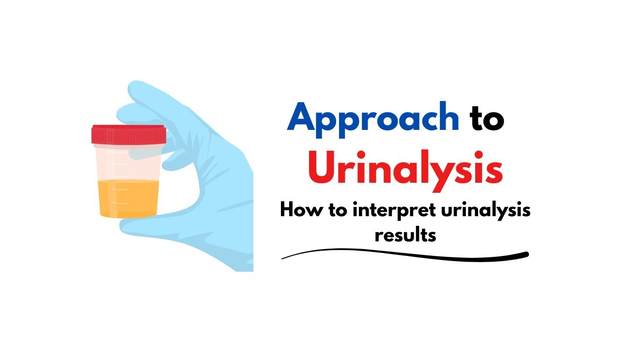 How To Interpret Urinalysis Results? #usmle #medschool #medicine - YouTube