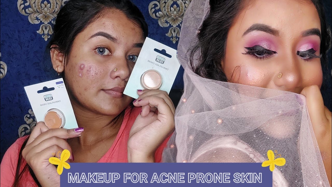 Acne hide | pimples hide makeup - YouTube