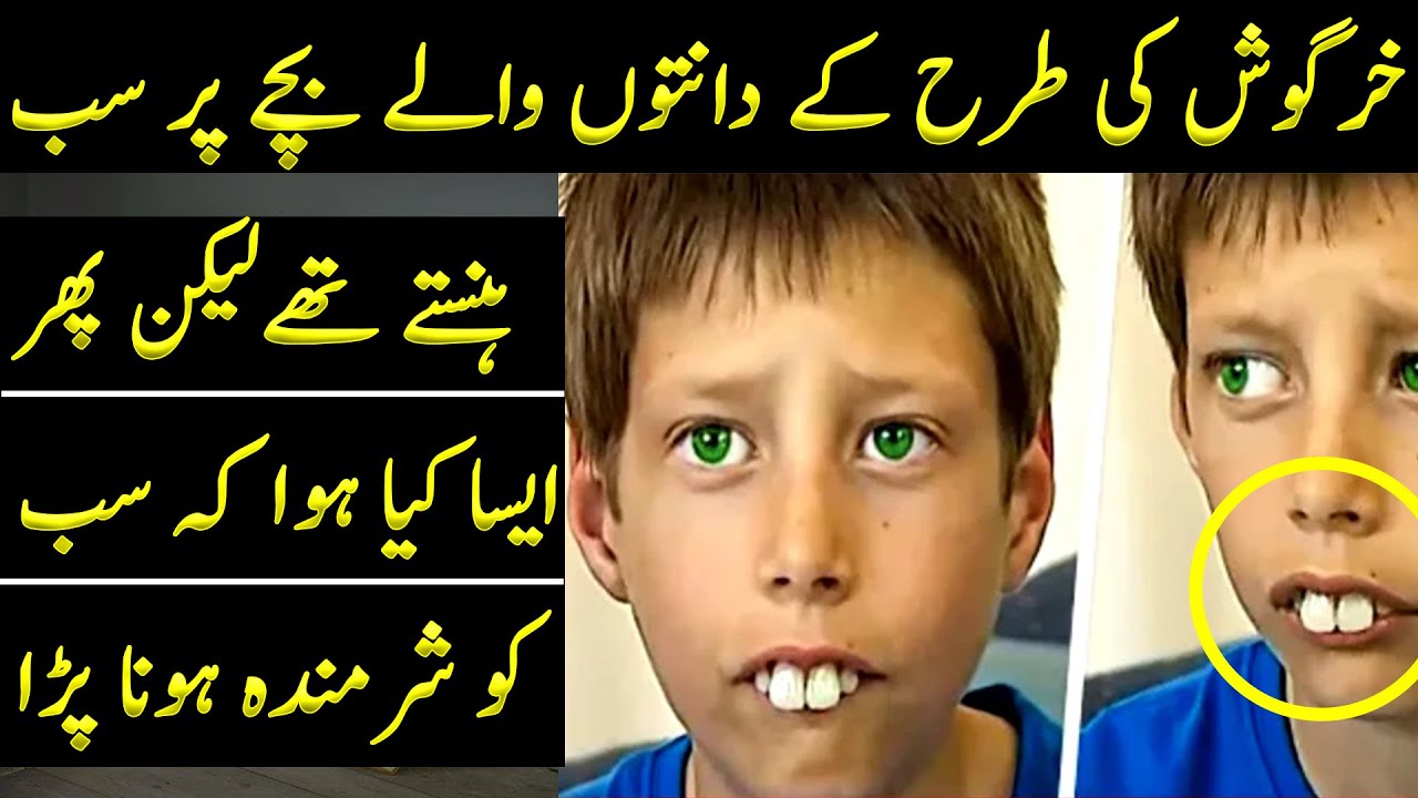 They Laughed at the Boy with Teeth Like a Rabbit and Then He Changed ...