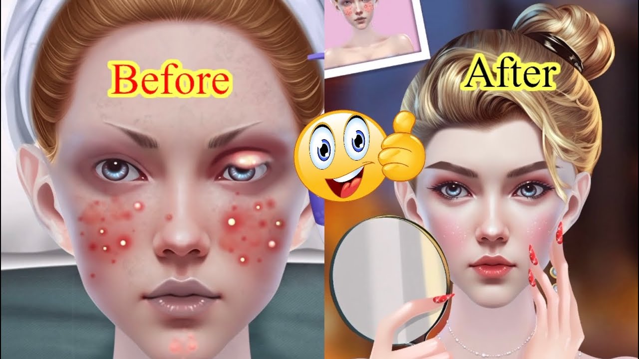 ASMR Satisfying Juicy Pimple Extraction animation #asmranimation #acne ...