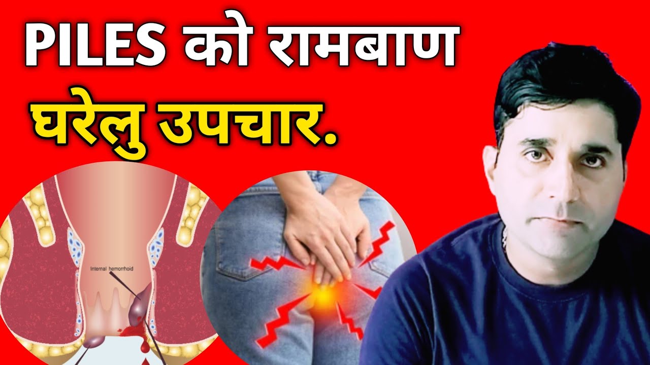 Piles ko gharelu upchar//Piles problem treatment// - YouTube