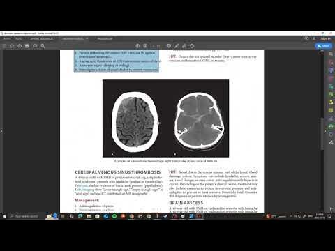 primary and secondary headaches algorithms - revision - YouTube