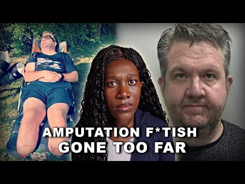 The Surgeon Who PURPOSELY Amputated His Legs for S*xual F*tish | Neil Hopper