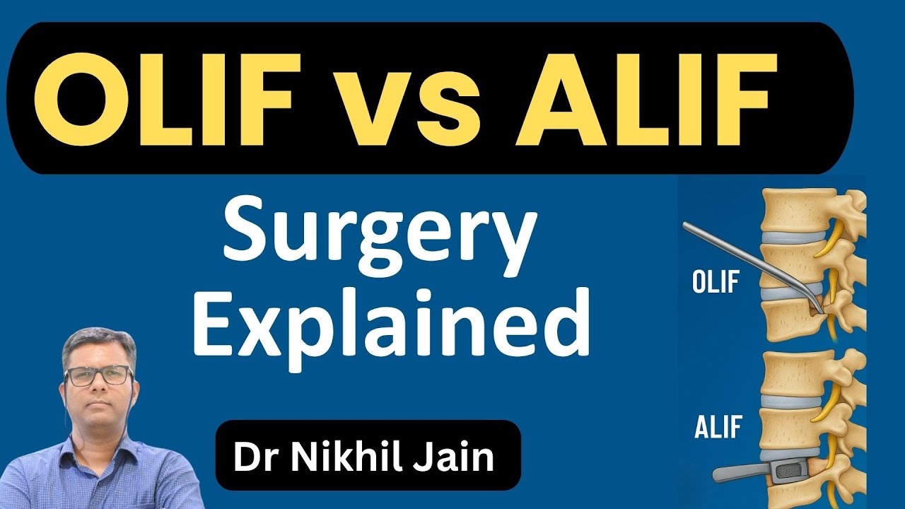What is OLIF & ALIF ? Procedure details, recovery expectations and more ...