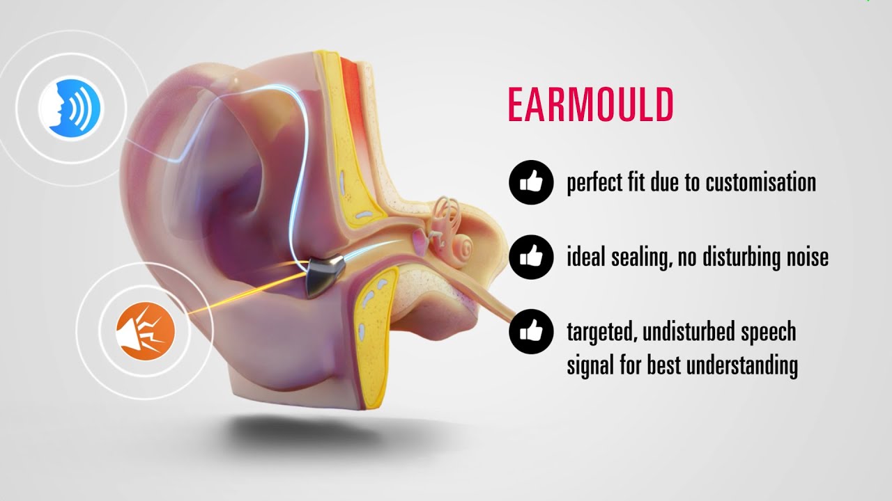 This is how an earmould helps to understand better - YouTube