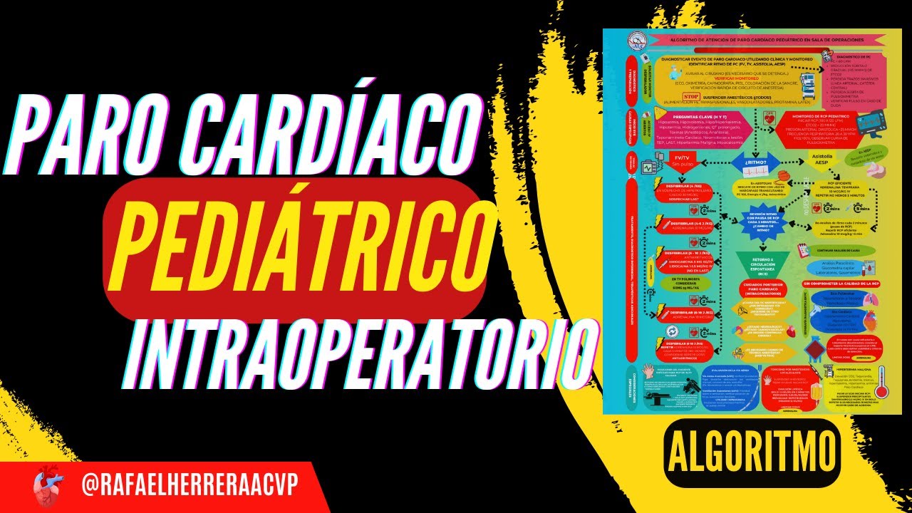 (PASO a PASO) Paro Cardíaco Pediátrico INTRAOPERATORIO: Básico y ...