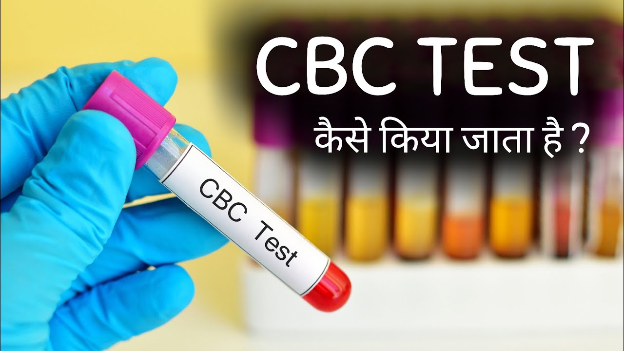 CBC test in hindi | CBC test kaise kiya jata hai | Complete blood count ...