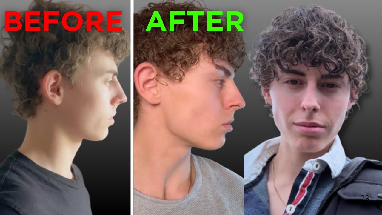 How To ACTUALLY Get Forward Growth (Full Guide) - YouTube