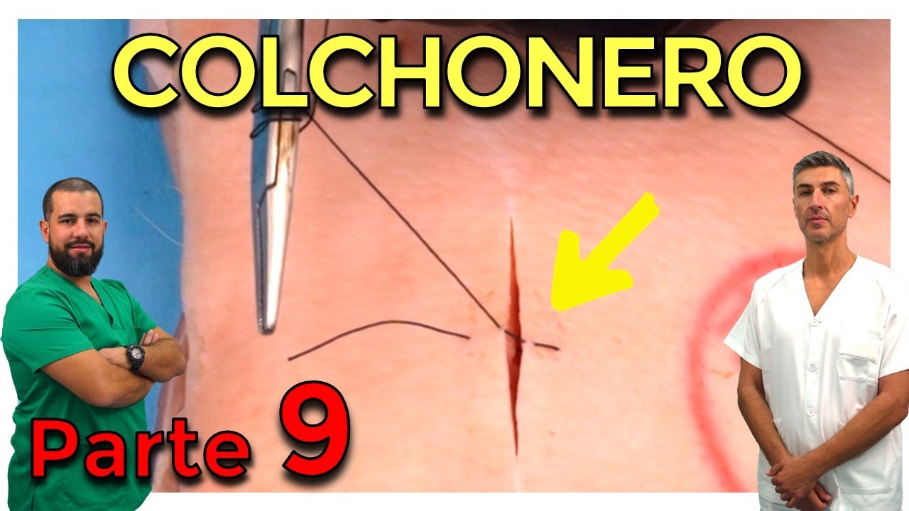 PUNTO COLCHONERO – CIRUGÍA MENOR y SUTURAS (Parte 9) - YouTube