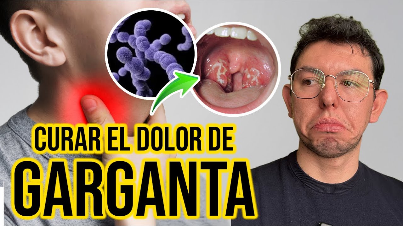 ASÍ es como SE TRATA un DOLOR DE GARGANTA | DrPoloGuerrero - YouTube