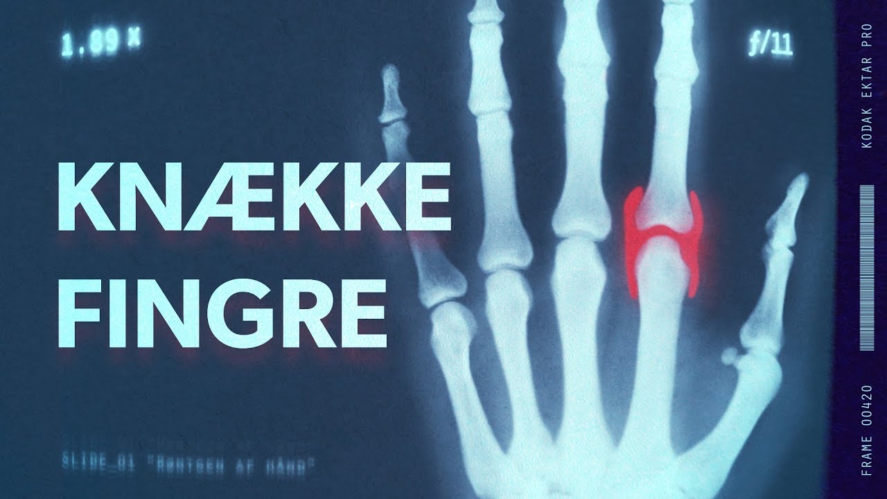 Får du gigt af at knække fingre? - YouTube