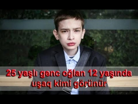 25 yaşlı gənc oğlan 12 yaşında  uşaq kimi görünür