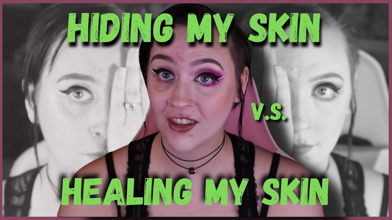 Hiding my Skin VS. Healing my Skin - YouTube