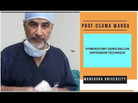 HYMENOTOMY USING BALLON DISTENTION - YouTube