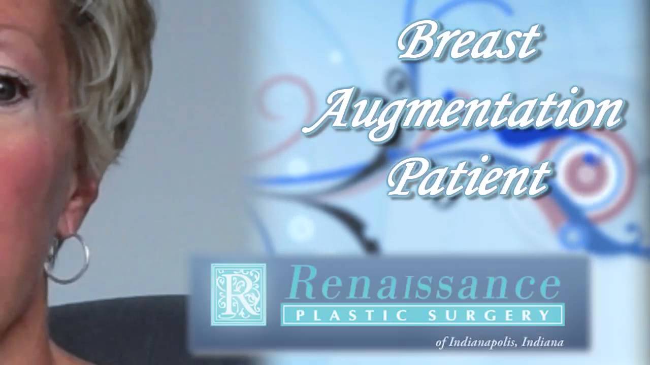 Breast Aug Testimonial - Experience With Dr Fata's Office - YouTube
