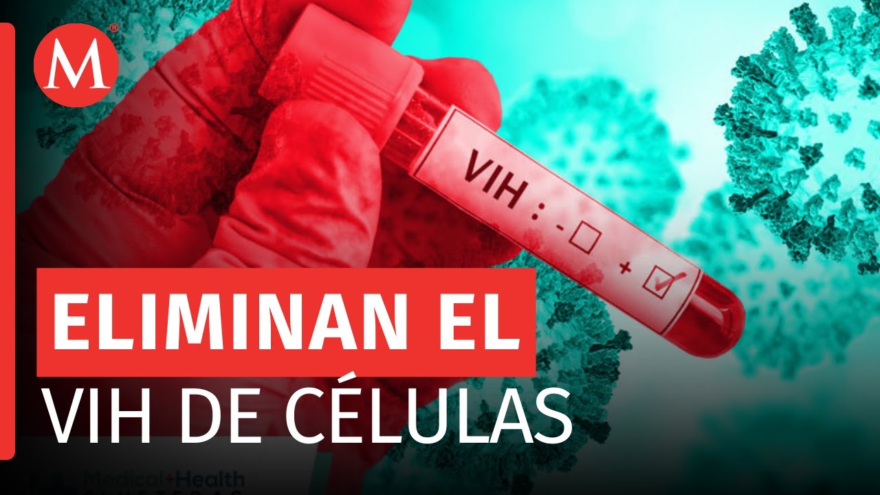 La Universidad de Ámsterdam elimina células infectadas de VIH con la ...