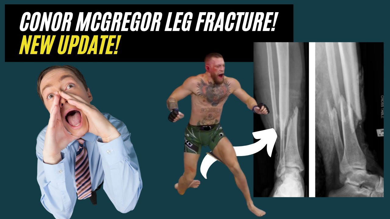 Conor McGregor Leg Injury Update! Tibial Rod Surgery & Recovery ...