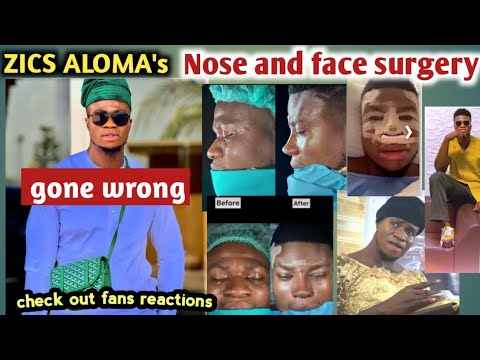Zics Aloma's Nose and Face Surgery Gone wrong/Internet on fire # ...