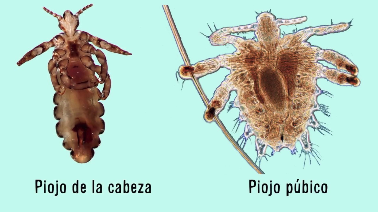 ¿Qué descubrimos estudiando los piojos? - YouTube