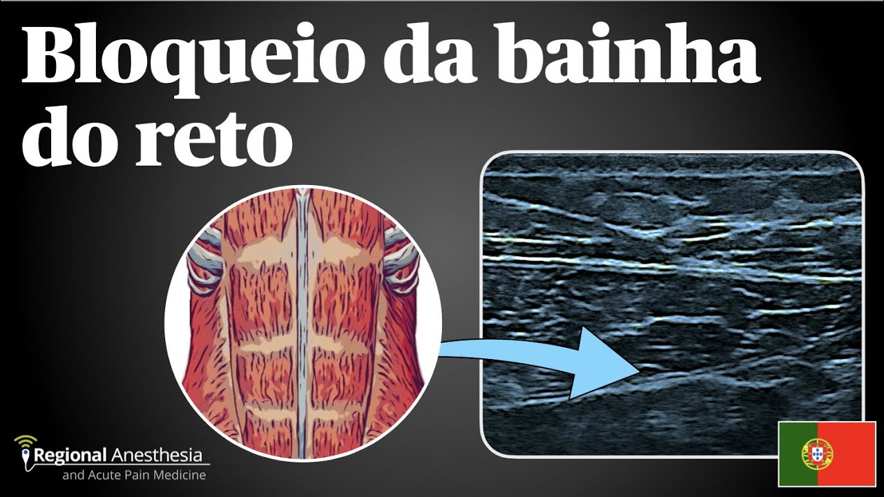 Bainha Do Reto Abdominal - RETOEDU