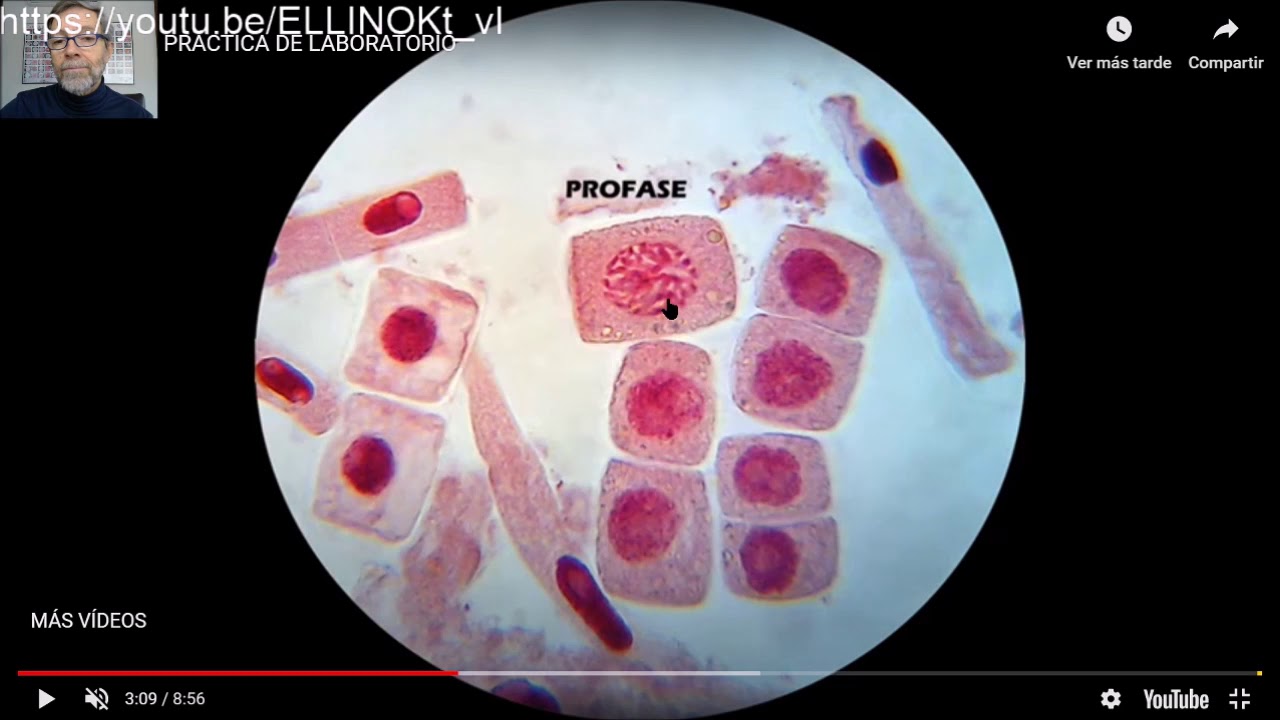 Etapas De La Mitosis Bajo El Microscopio Células Madre Que Se Dividen