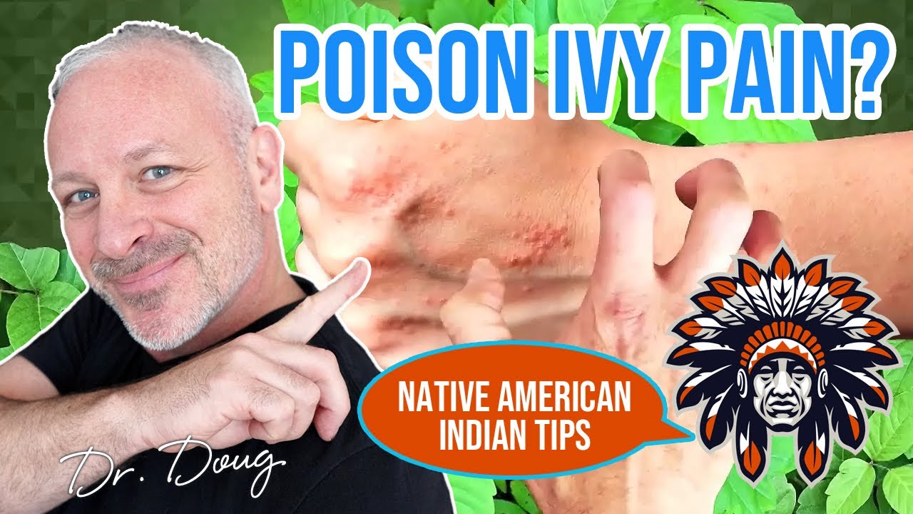 POISON IVY: Native American Indian Tips! - YouTube