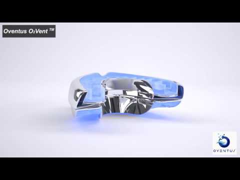 CitiDent Treats Sleep Apnea with Cutting-Edge Oventus O2Vent Technology