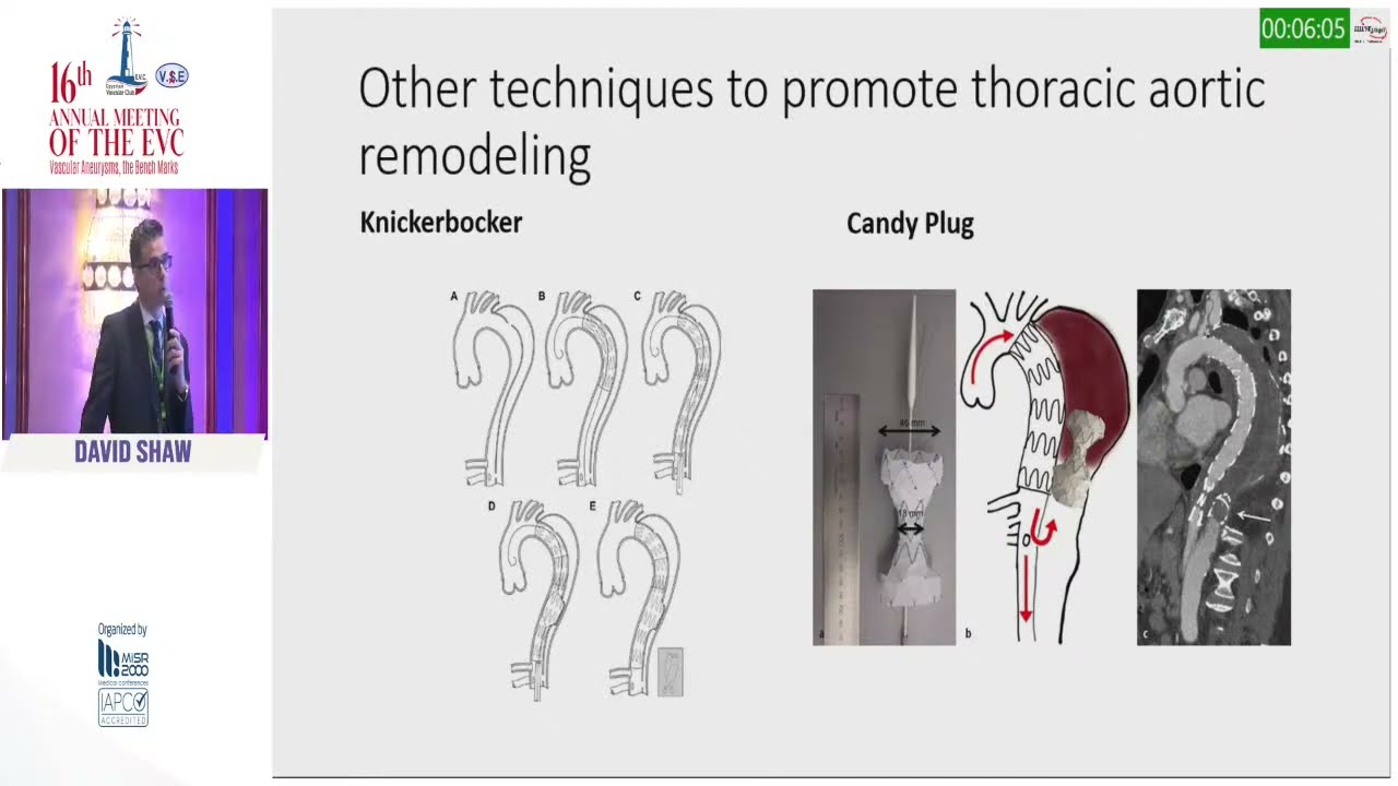 Vascular online training Prof David Show how to stabilize BEVAR and ...
