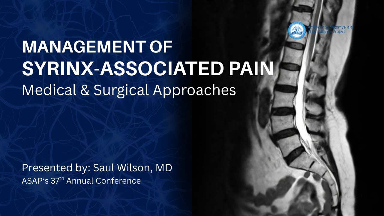 Management of Syrinx-Associated Pain (Syringomyelia): Medical ...