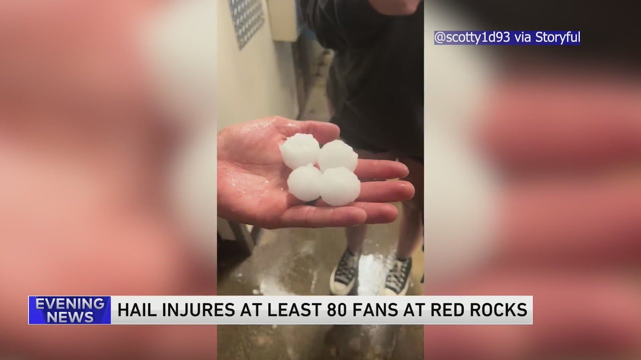 Nearly 100 concertgoers hurt by 'golf-ball size' hail at Red Rocks ...