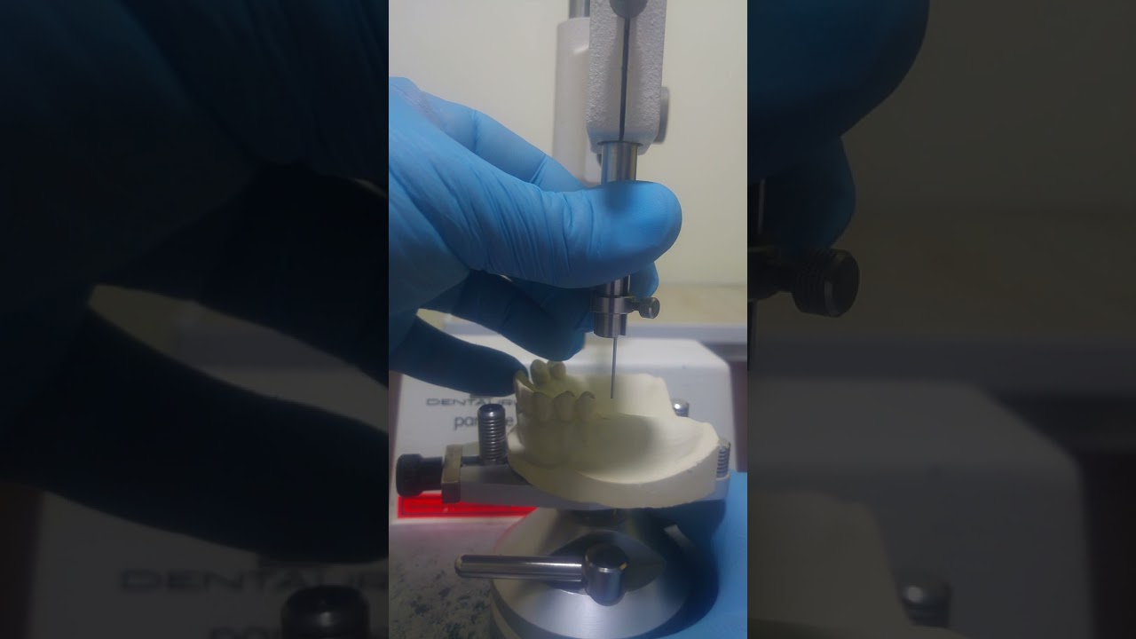 Introduction to dental surveying & Analyzing Rod - YouTube