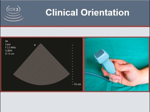 Cardiac EDE/POCUS Probe orientation video - YouTube