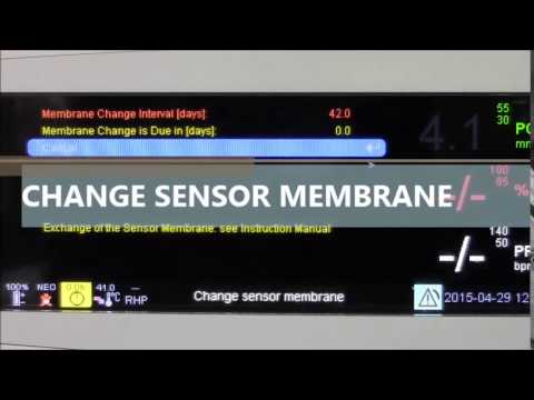 Change sensor membrane alarm in Sentec Digital Monitor - YouTube