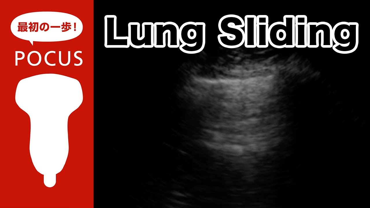 sliding lung【肺超音波・POCUS】 - YouTube