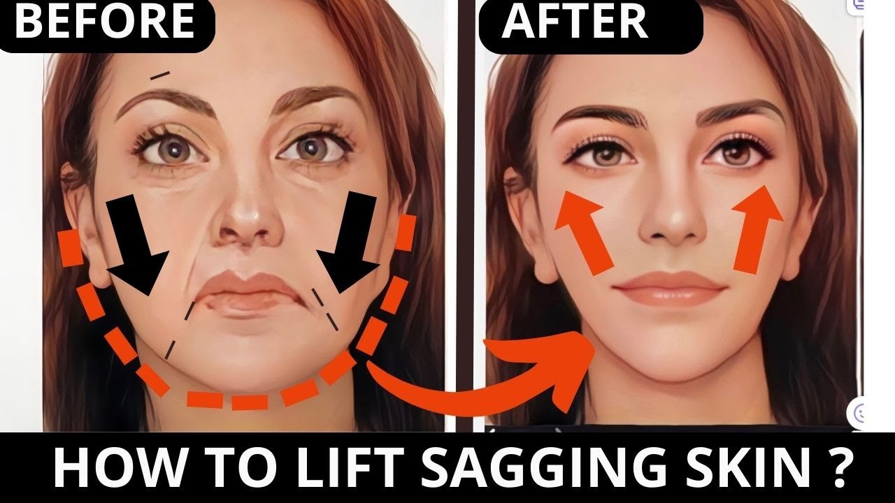 🛑 HOW TO TIGHTEN FACE SKIN BY EXERCISE ? JOWLS, SAGGY CHEEKS, LAUGH ...