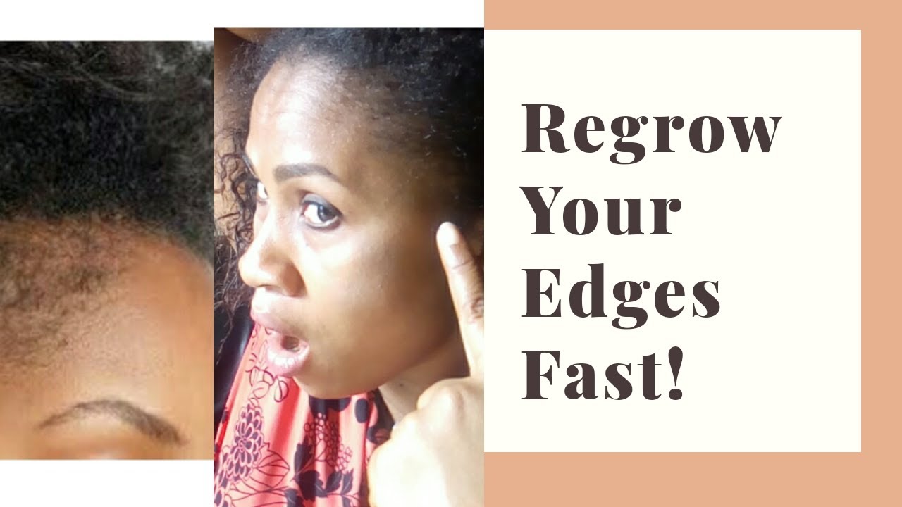 GROW BACK YOUR EDGES FAST!! - YouTube