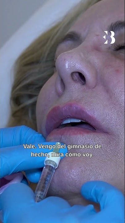 Aumento de Labios y Neuromoduladores con la Dra. Elena Berezo y Belén Rodriguez I Clínicas EB ...