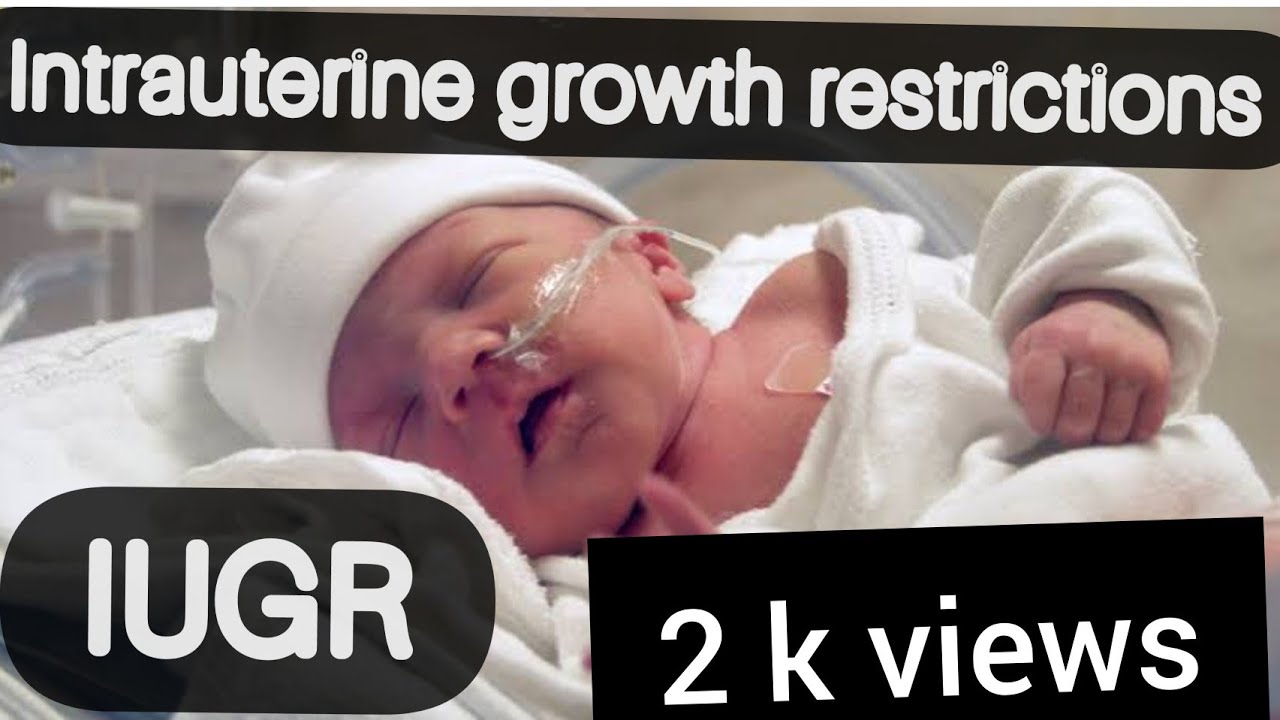 Intrauterine growth restrictions | IUGR Types | - YouTube