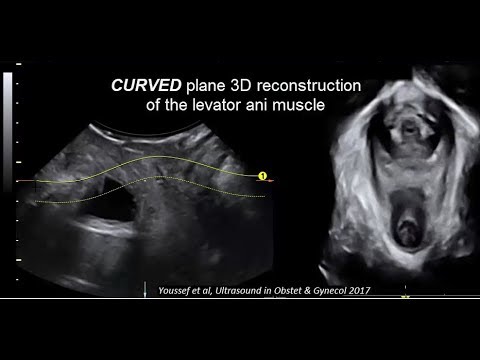3D reconstruction of pelvic floor muscles - YouTube