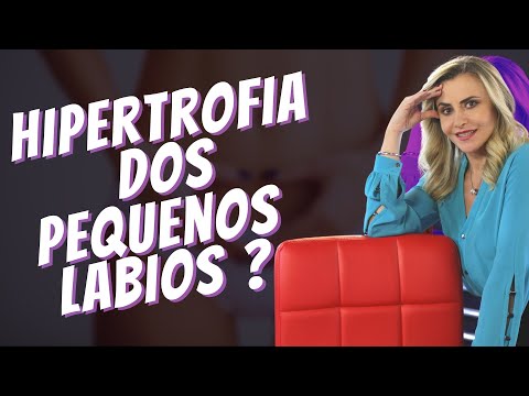 Hipertrofia dos pequenos lábios. Você sabe o que isso? Dra. Patrícia explica