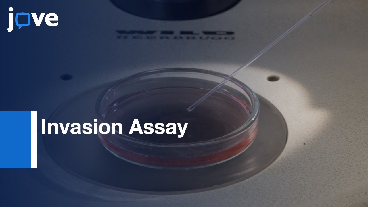 Invasion Assay: to test Cancer cells and anti-Invasive compounds ...