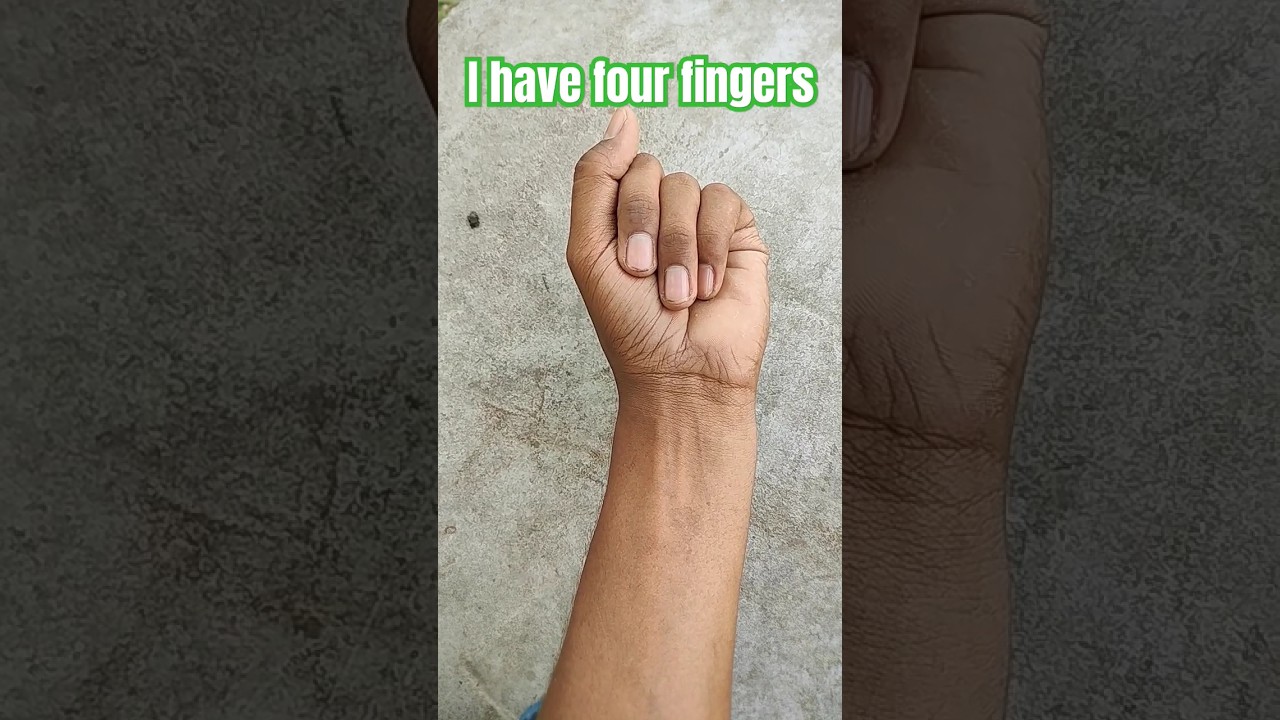 i have four fingers #viral #shorts - YouTube
