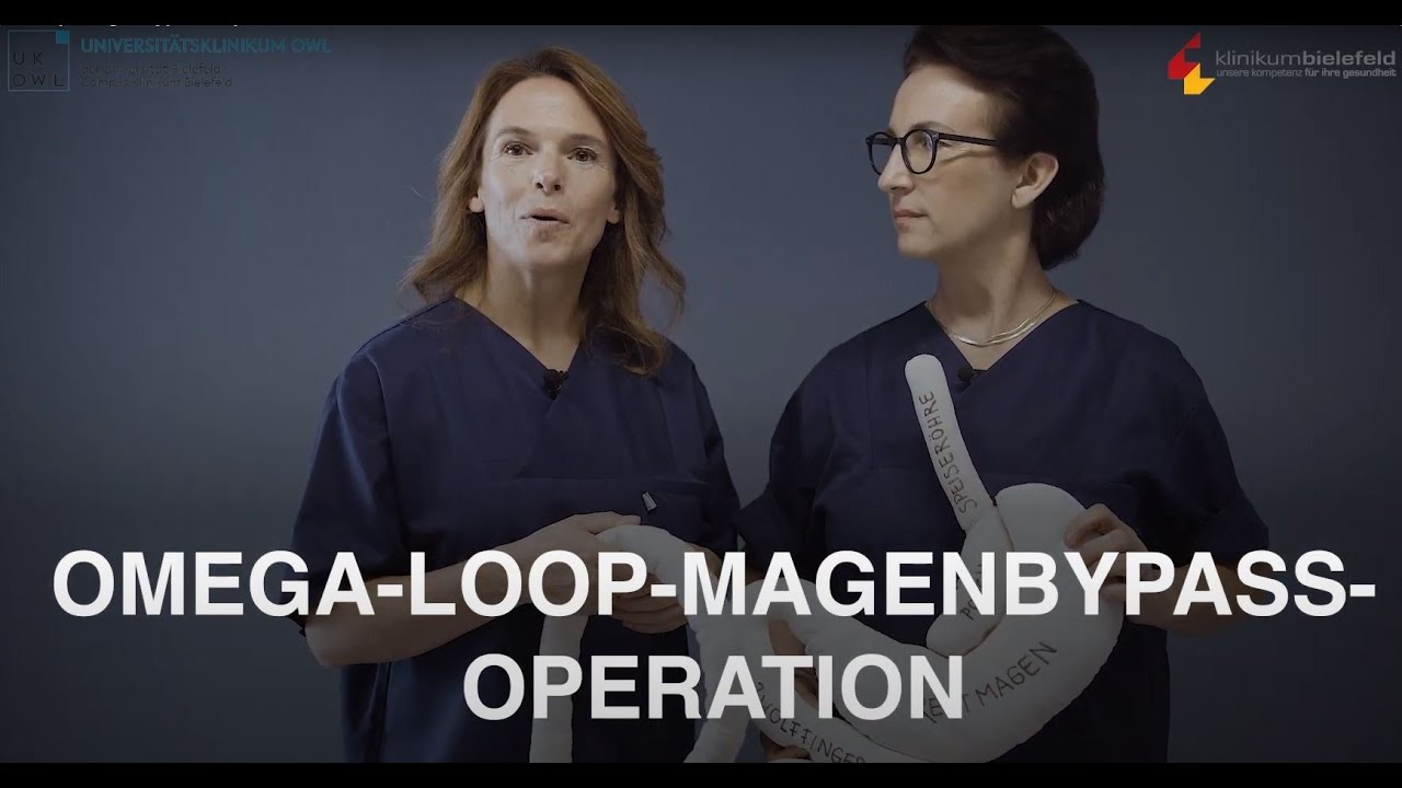 Adipositas: Omega-Loop-Magenbypass-Operation - einfach erklärt - YouTube