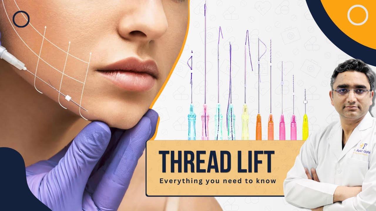 Thread Lift or Non-Surgical Facelift for Mid Face Sagging | Get Rid of ...